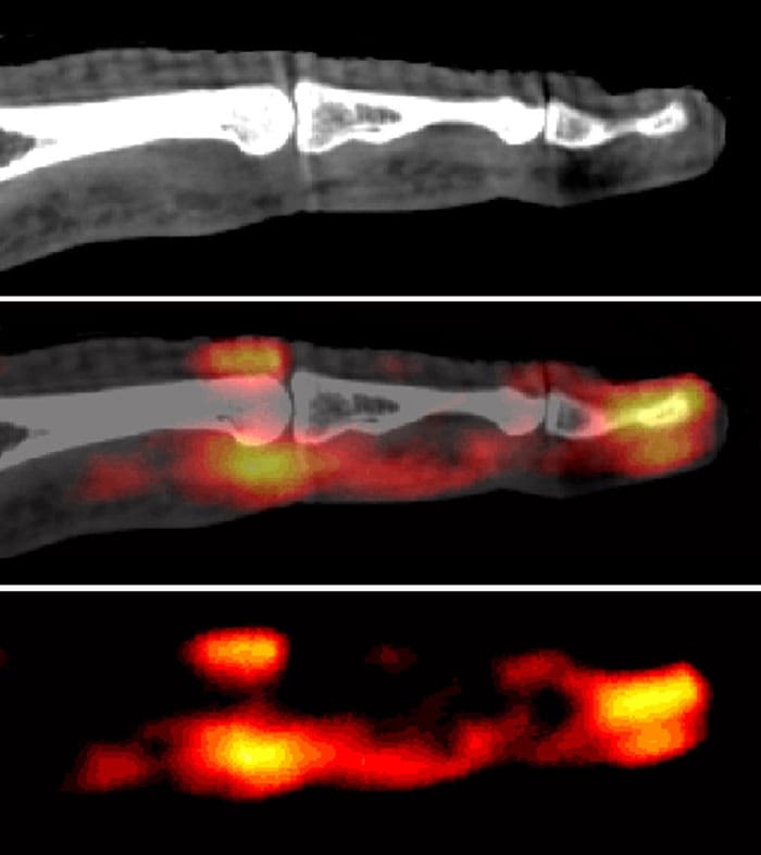 State of the Art in PsA: A Clinical Guide on Assessment and Treatment