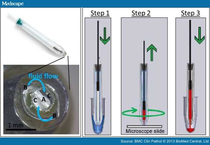 An Instrument System for Dissecting Slide-mounted Tissue - Page 3