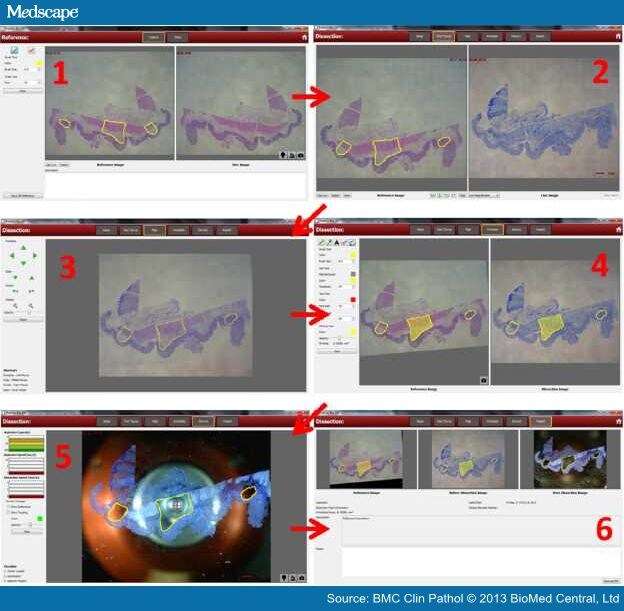 An Instrument System for Dissecting Slide-mounted Tissue - Page 3