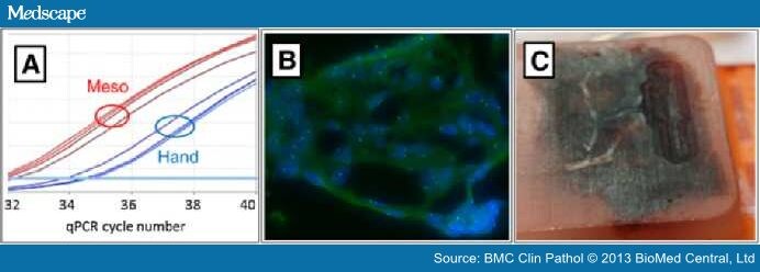 An Instrument System for Dissecting Slide-mounted Tissue - Page 4