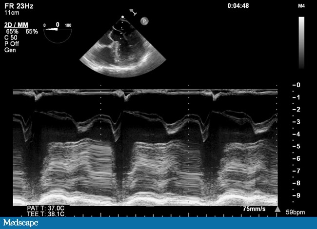 Would You Be Misled by These TEE and TTE Images?