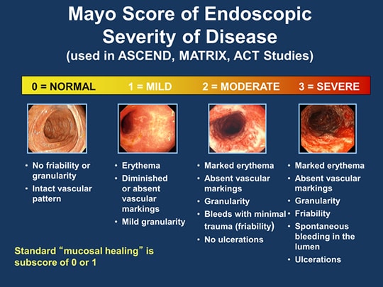 Inflammatory Bowel Disease: Front-line Issues in Diagnosis & Management ...
