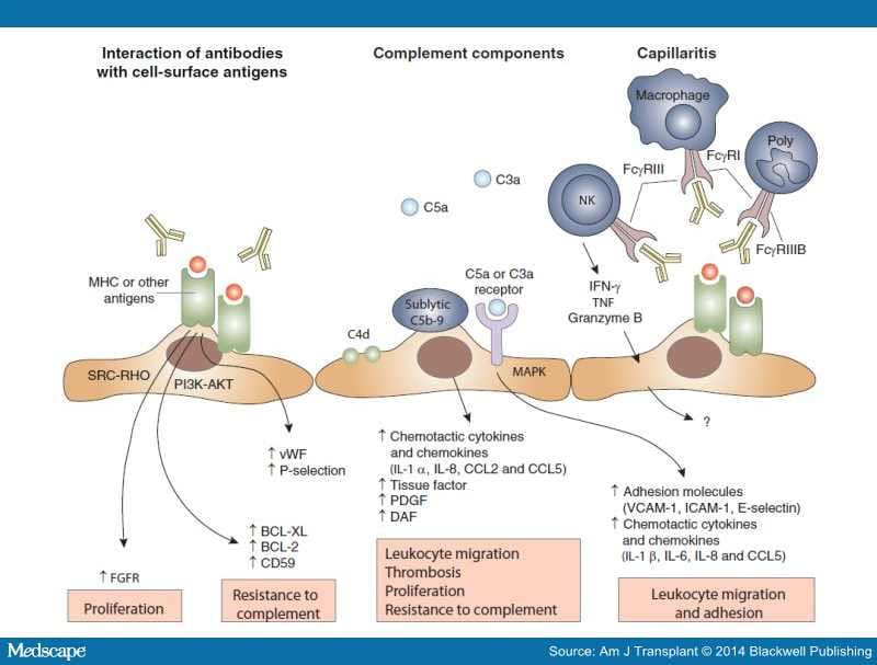 Antibody-Mediated Rejection Kidney Transplant Guidelines at Phillip ...