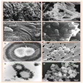 The Role of Nanobacteria and Biofilms in Health and Disease