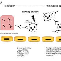 Spotlight on Pathogenesis of TRALI: HNA-3a (CTL2) Antibodies