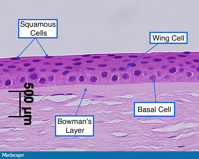 Corneal Abrasions: Managing a Commonly Occurring Injury - Page 2