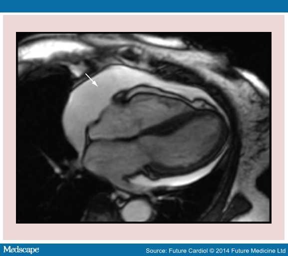 Cardiac CT and Cardiovascular MRI in Pericardial Disease - Page 3