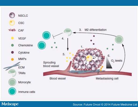 Hypoxic Tumor Microenvironment: Driving NSCLC Tumorigenesis - Page 3