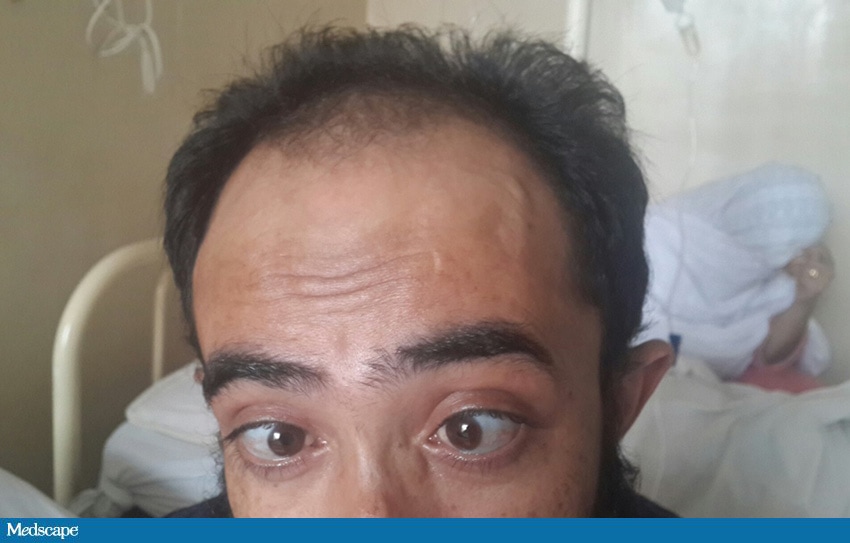 A Young Man With Difficulty Walking and Double Vision - Page 2