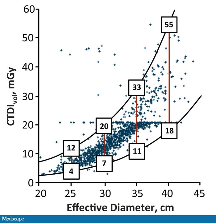 CT Radiation Dose Monitoring: Current State and New Prospects
