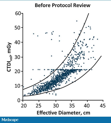 CT Radiation Dose Monitoring: Current State and New Prospects