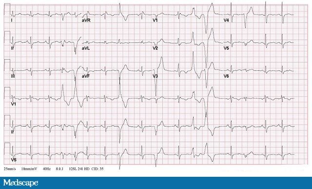 Can You Put This Together?