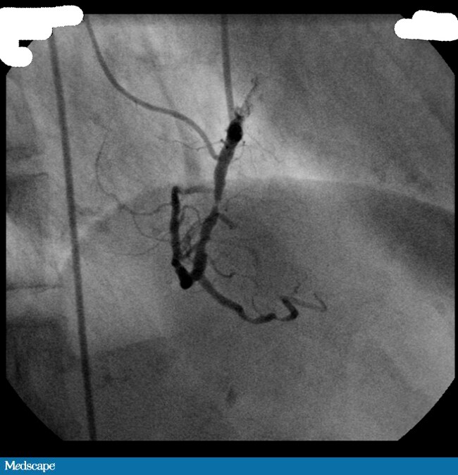 Where Is the Culprit Lesion? - Page 2