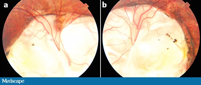 The Girl With Roving Eyes