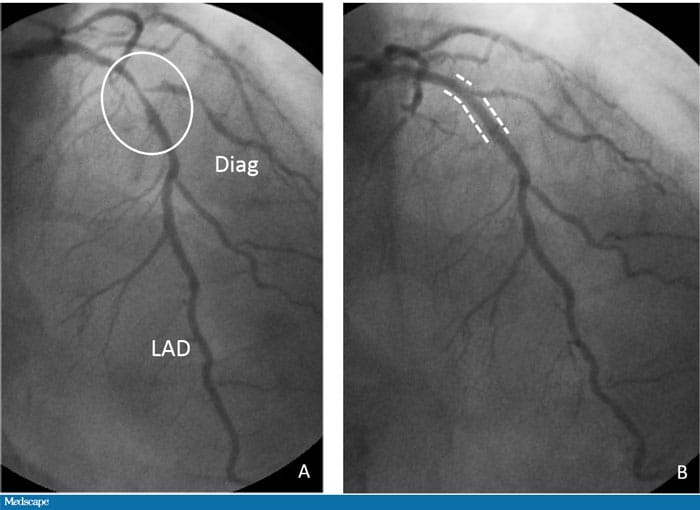 Curious Anticoagulation Cases