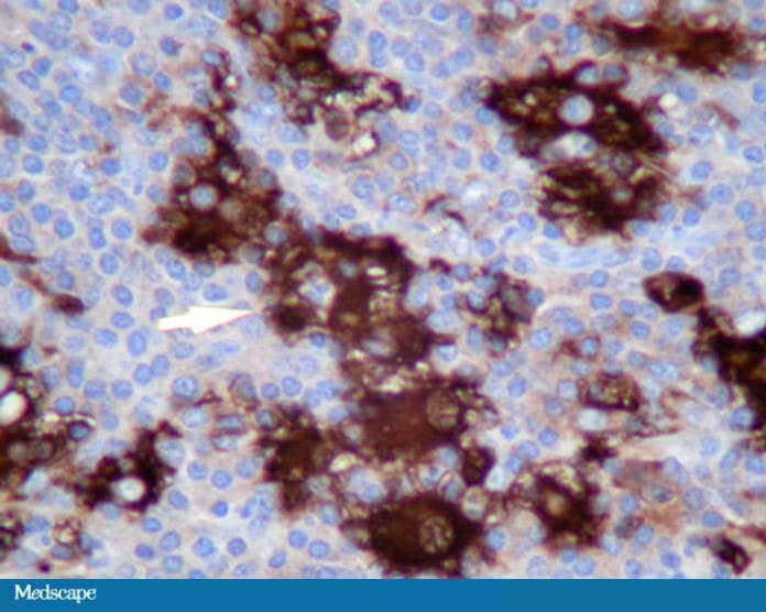 A 42-Year-Old Man With a Right Ear Mass - Page 2