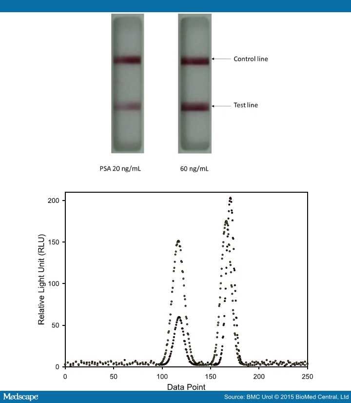 Gold Immunochromatographic Strips for Determining PSA - Page 3