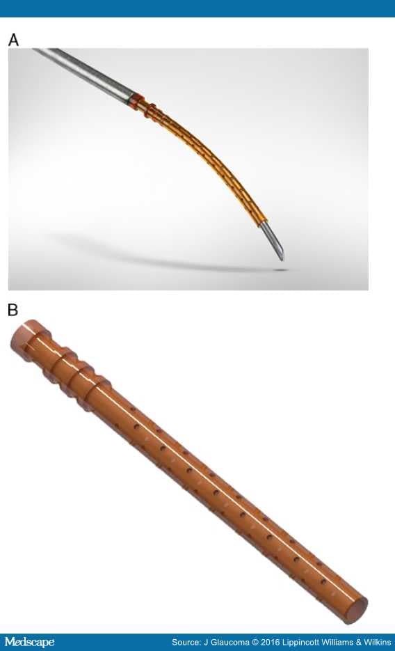 Initial Clinical Experience With the CyPass Micro-Stent - Page 2
