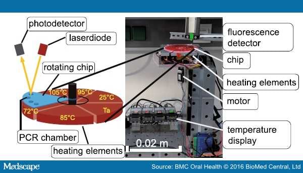 A Point-of-Care-Device for Periodontal Pathogen Detection - Page 3