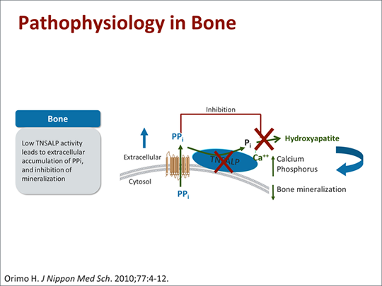 Hypophosphatasia: Understanding the Disease and Improving Diagnosis ...
