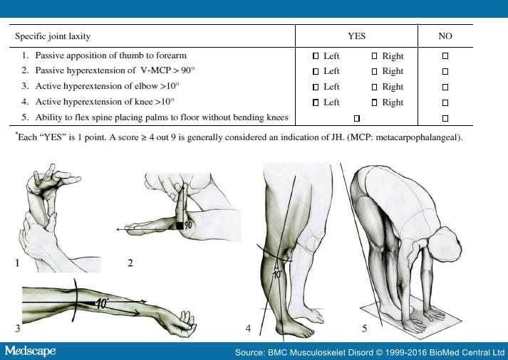 Arthralgias, Fatigue, Paresthesias and Visceral Pain - Page 2