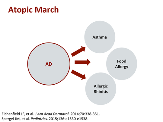 What's New in Atopic Dermatitis: Updates From AAD 2016