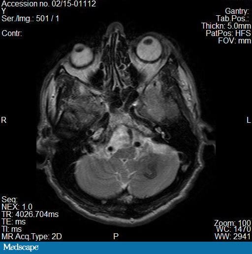 A 62-Year-Old Man With Involuntary Facial Movements - Page 2