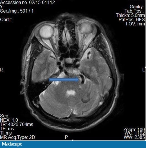 A 62-Year-Old Man With Involuntary Facial Movements - Page 2