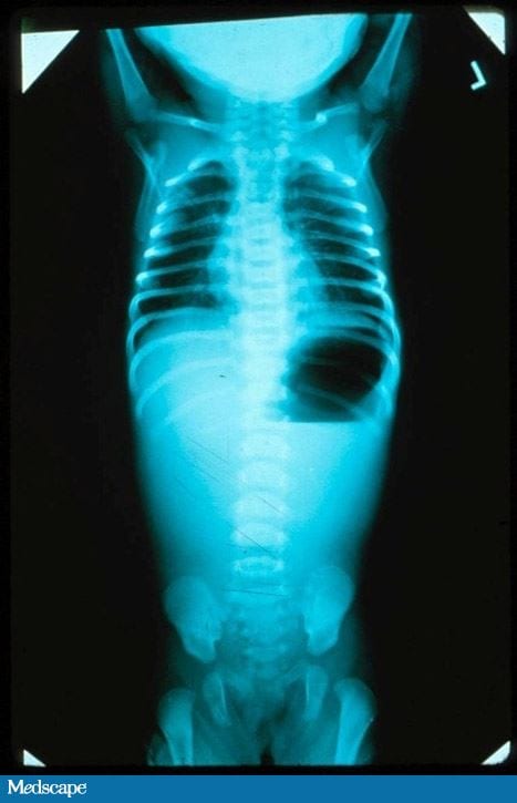 A 3-Day-Old Boy With Bilious Emesis - Page 4