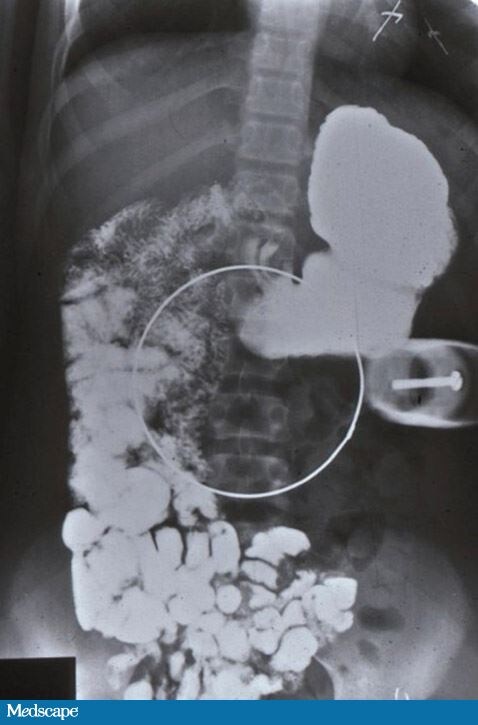 A 3-Day-Old Boy With Bilious Emesis - Page 4