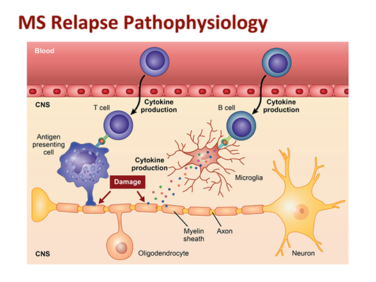 Improving Care in Multiple Sclerosis: A Nursing Perspective