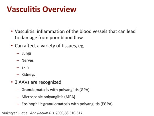 Challenges and Opportunities in the Management of ANCA-Associated ...
