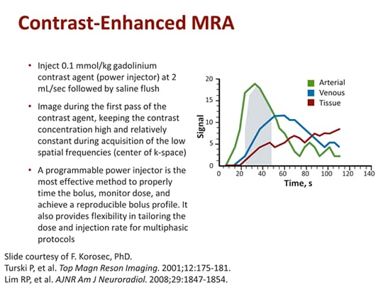 Best Practices for the Use of MRA in Stroke Diagnosis (Transcript)