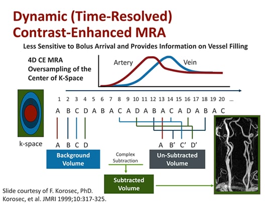 Best Practices for the Use of MRA in Stroke Diagnosis (Transcript)