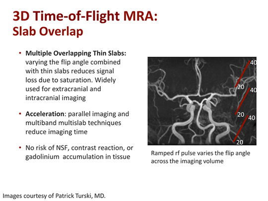 Best Practices for the Use of MRA in Stroke Diagnosis (Transcript)