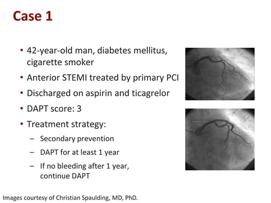 What Has Been Tried and What Is True? Getting the Most From DAPT and ...
