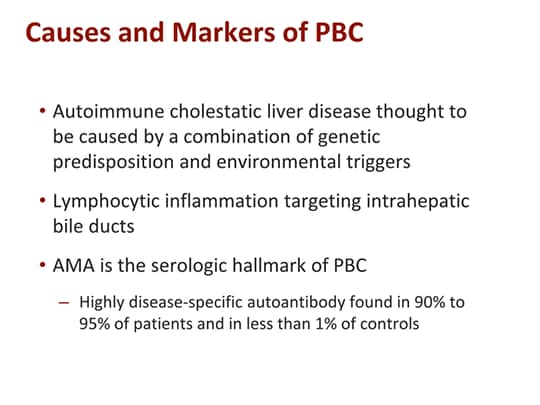 Primary Biliary Cholangitis: Pathophysiology, Diagnosis, and Natural ...