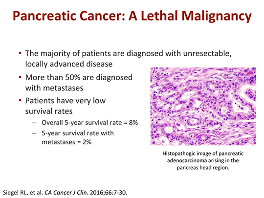 Management of Advanced Pancreatic Adenocarcinoma: The Nurse View ...