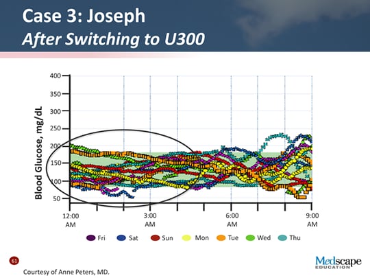 Concentrated Insulin: Deciphering the When and the How for Better ...