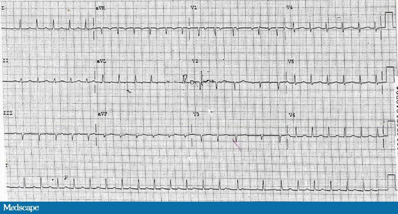 ECG Challenge: Respiratory Distress and a Rapid Rate