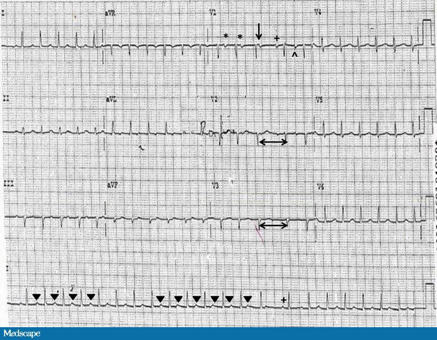 ECG Challenge: Respiratory Distress and a Rapid Rate - Page 2