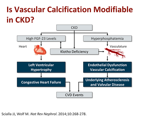 Key Concepts in CKD-MBD: Essentials for Improving Outcomes (Transcript)
