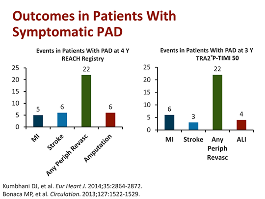Understanding PAD: Recognition, Diagnosis and Treatment (Transcript)