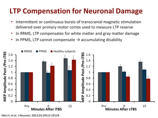 What Predicts Disability Progression in Multiple Sclerosis? (Transcript)