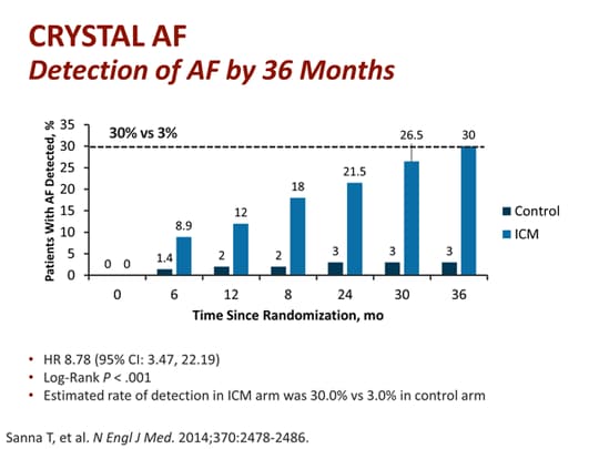 Taking the "Cryptogenic" Out of Cryptogenic Stroke (Transcript)