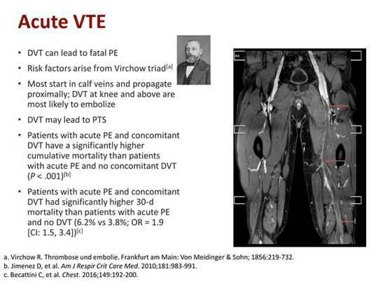 Interventional Management of DVT: Collaborative Strategies and ...