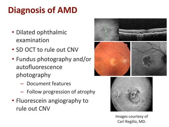 Dry AMD and GA: The Present and Future (Transcript)
