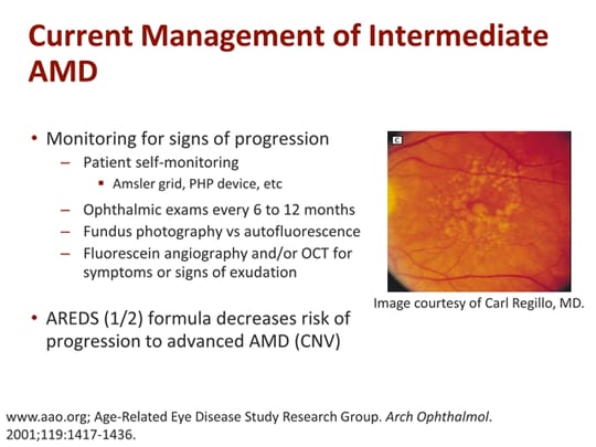 Dry AMD and GA: The Present and Future (Transcript)