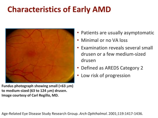 Dry AMD and GA: The Present and Future (Transcript)