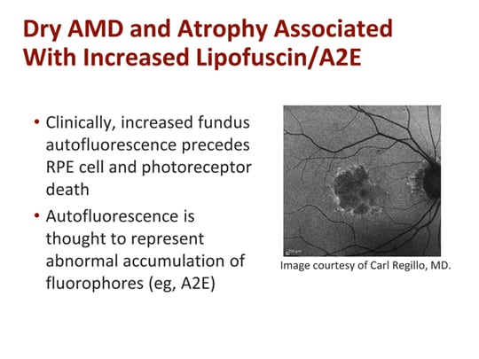 Dry AMD and GA: The Present and Future (Transcript)